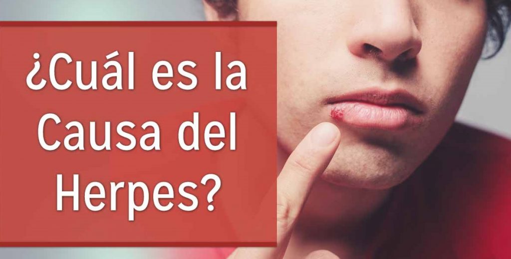 Herpes Labial - causa: 6 causas del herpes labial